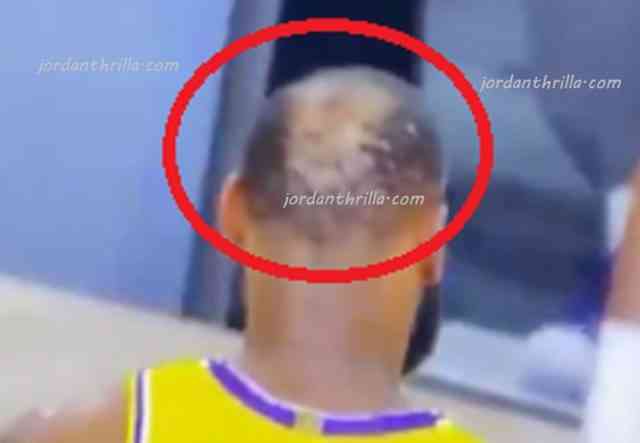 Lebron James Massive Bald Spot Goes Viral After He Destroy Clippers ...