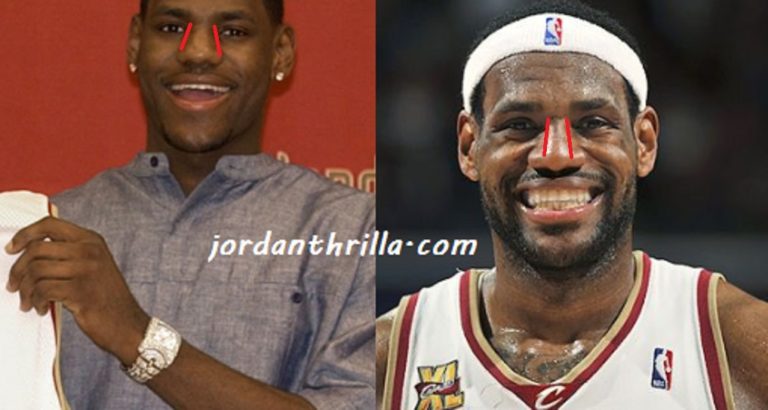 Anonymous Doctor Accuses Lebron James of Getting a Nose Job Plastic Surgery