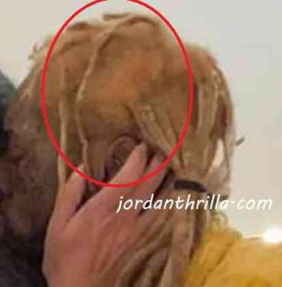 Lil Wayne's Balding Head Extreme Hair Loss and Dreads Falling Out Goes ...