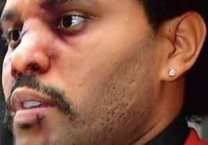 Usher Allegedly Beat Up The Weeknd Broke His Nose and Busted his Lip ...