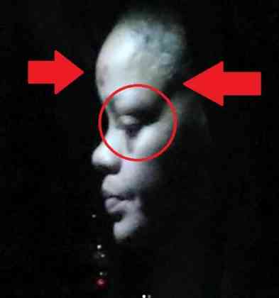 Photos Surface of Rihanna's Face Bruised and Battered After Serious E ...