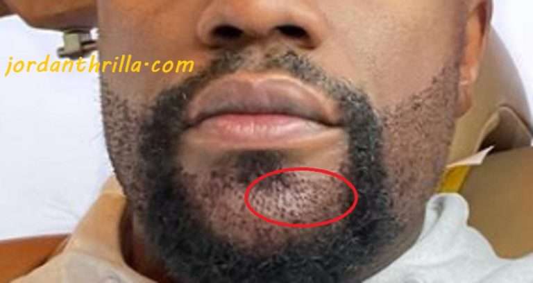 Did Floyd Mayweather Get a Hair Transplant? New Photo Sparks Floyd ...