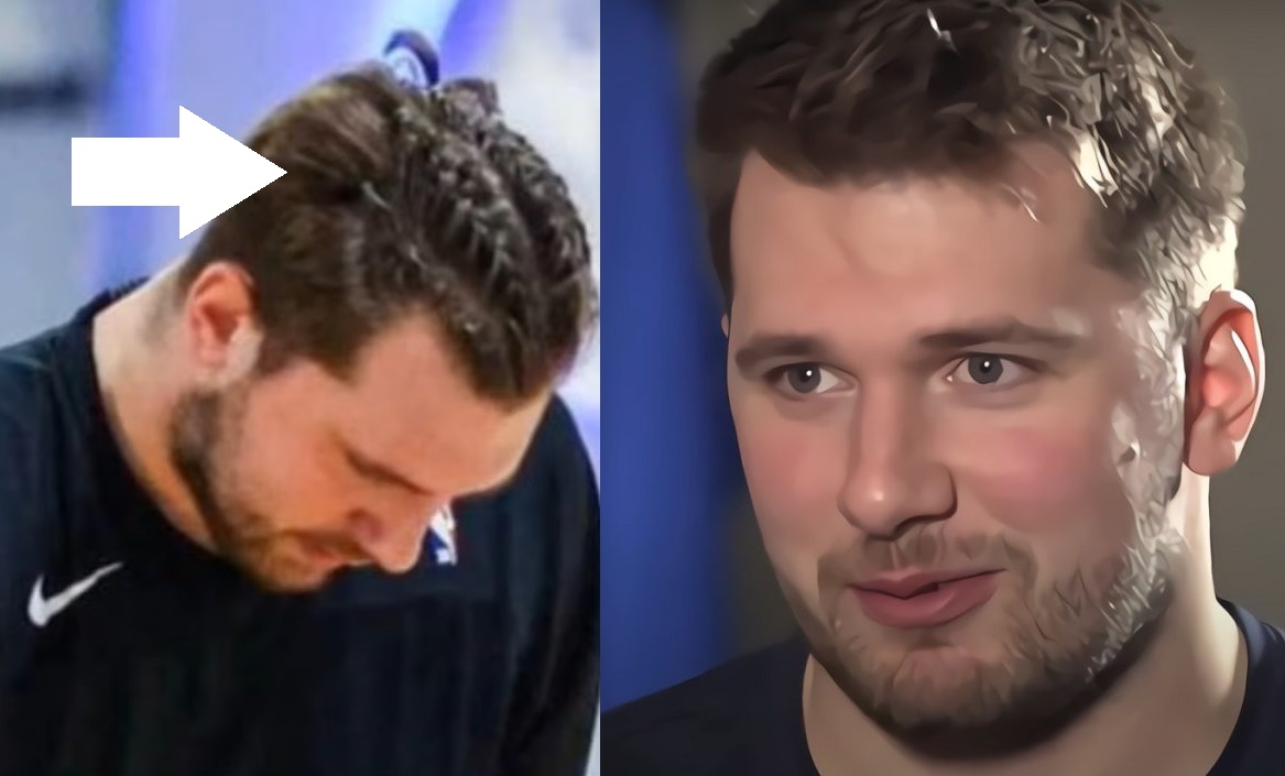 Luka Doncic's Braids Hairstyle Leads to Accusations of Cultural ...