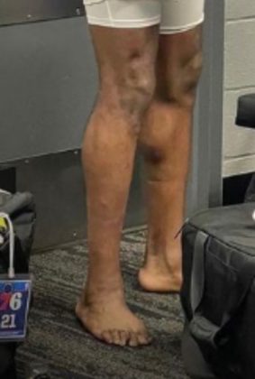 James Harden's 'Dead' Zombie Feet Go Viral After Rachel Nichols Locker ...