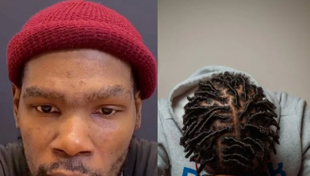 Kevin Durant Massive Bald Spot at NETS Practice Goes Viral