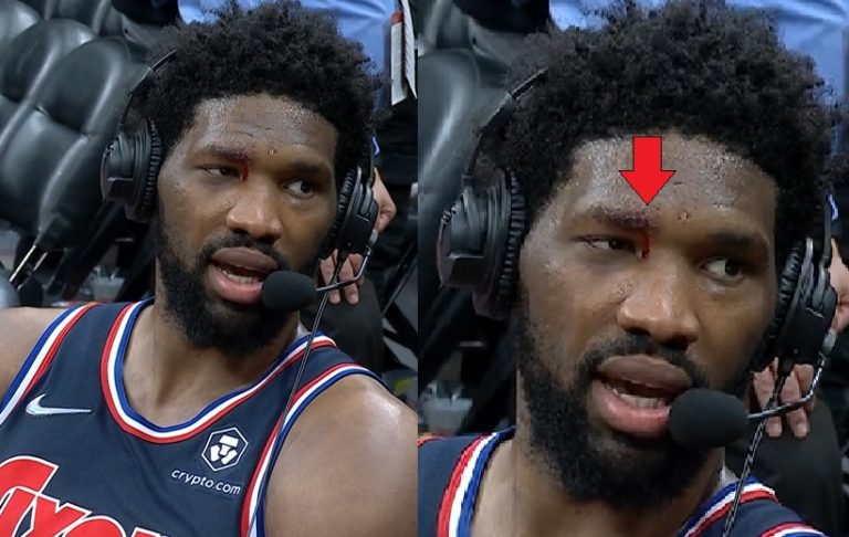 Joel Embiid's Eye Bleeding During Postgame Interview After Eliminating ...