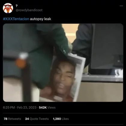 Did XXXTentacion's Autopsy Photos Leak on Social Media?